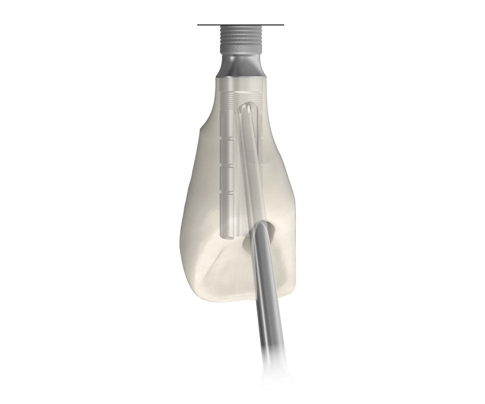 Angulated Screw Channel – Prime Dental Solutions