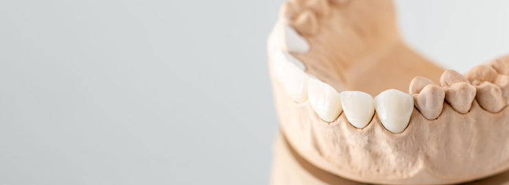 Layered Zirconia – Prime Dental Solutions